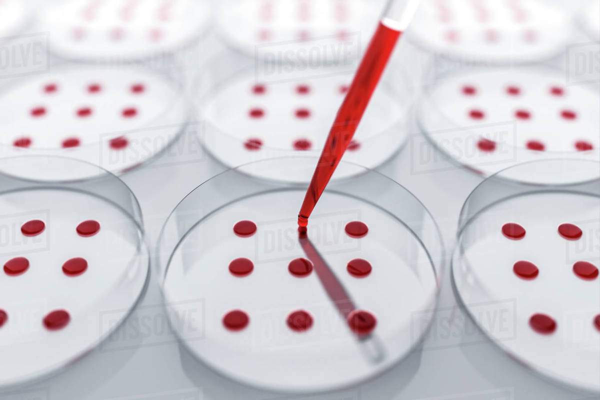 Blood sample tested on petri dish in laboratory - Royalty-free Stock ...