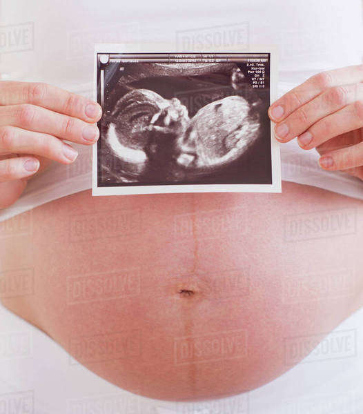 Pregnant woman with ultrasonography scan - Royalty-free Stock Photo ...