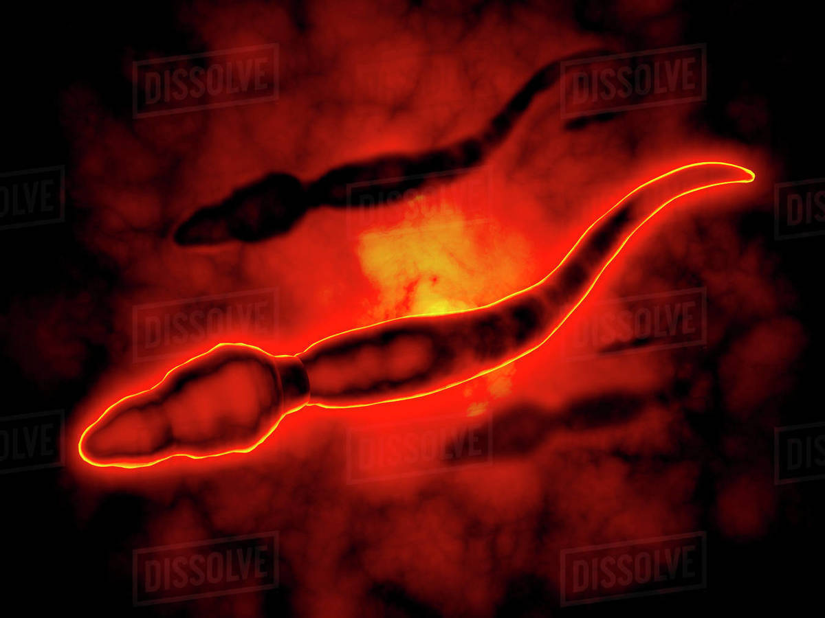 Microscopic view of male sperm cells. - Stock Photo - Dissolve