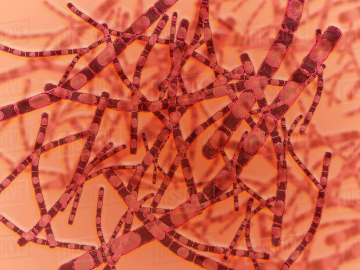 Microscopic view of Anthrax. Anthrax is an acute disease caused by the ...