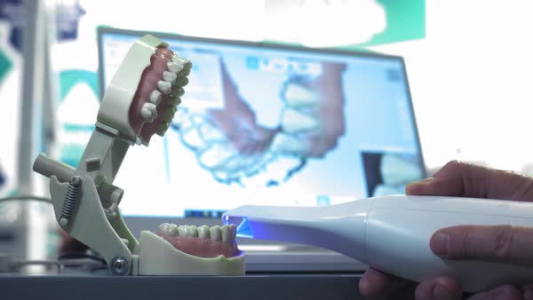 Manual 3D scanner for teeth. The doctor scans a cast of teeth on the ...