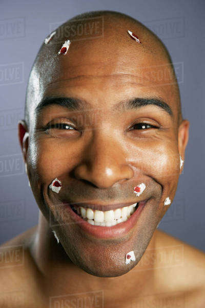 African American man with shaving cuts - Stock Photo - Dissolve