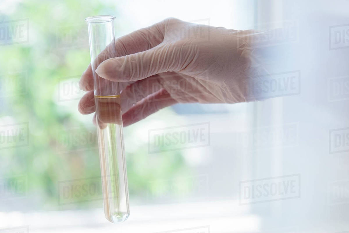 Hand holding test tube with yellow liquid - Royalty-free Stock Photo ...