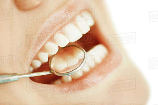 Dentist examining female teeth with angled mirror - Stock Photo - Dissolve