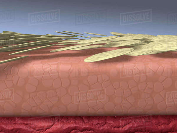 Dry skin flaking off from the epidermis. Epidermal squamous cells ...