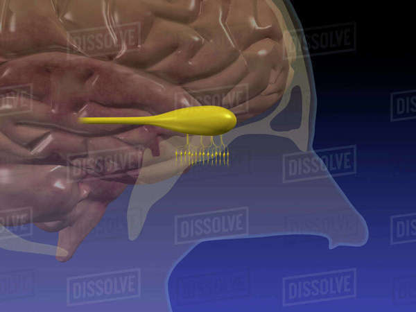 View of human nasal passage with brain and the olfactory bulb, the ...