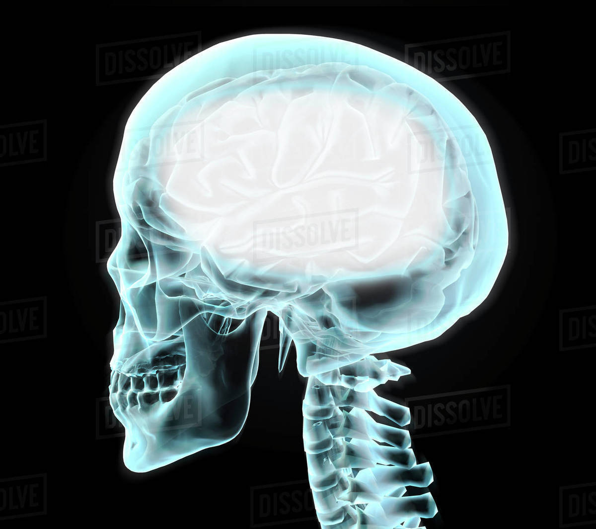 Skull brain with message box, Digitally Generated Image by Hank Grebe ...