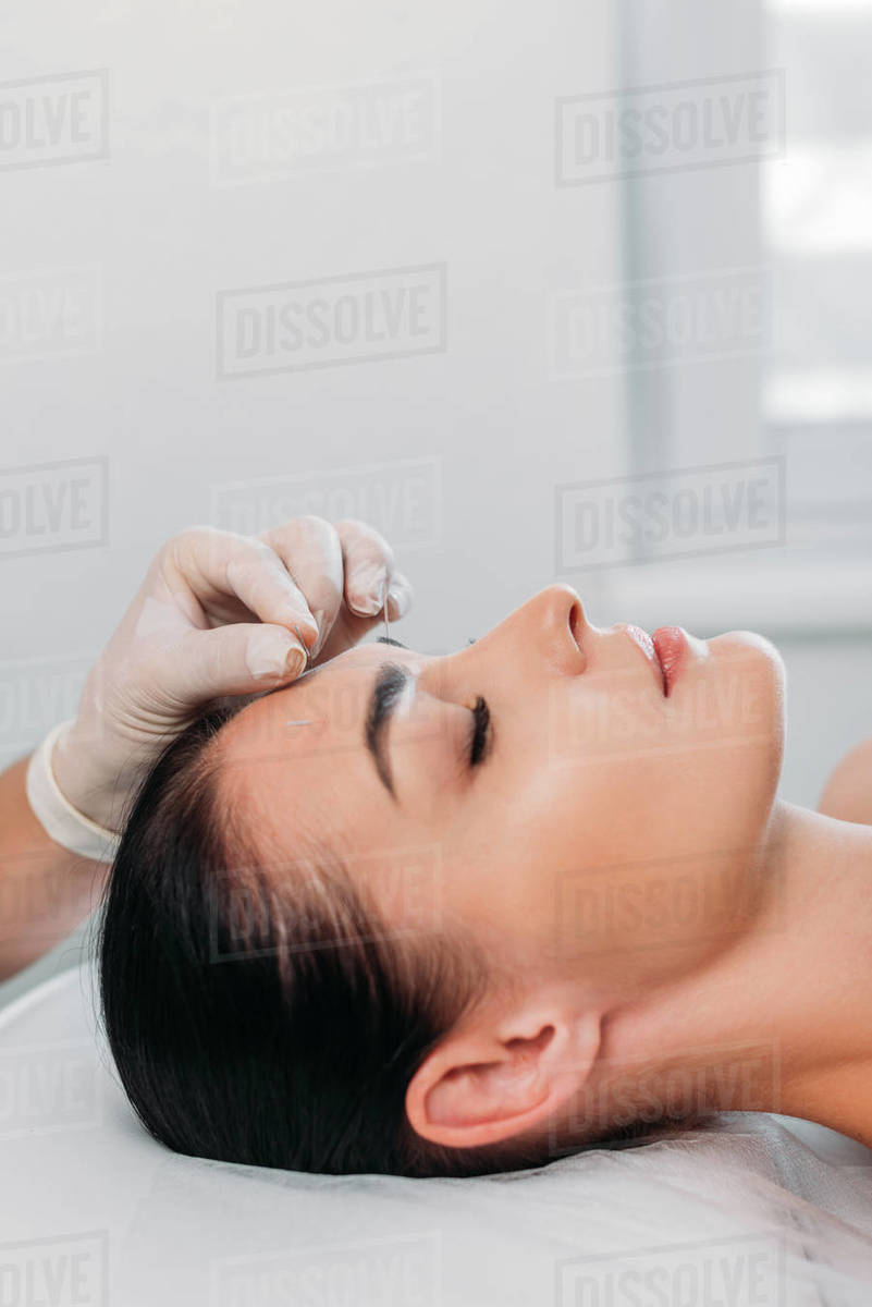 Partial view of cosmetologist putting needle on womans forehead during ...