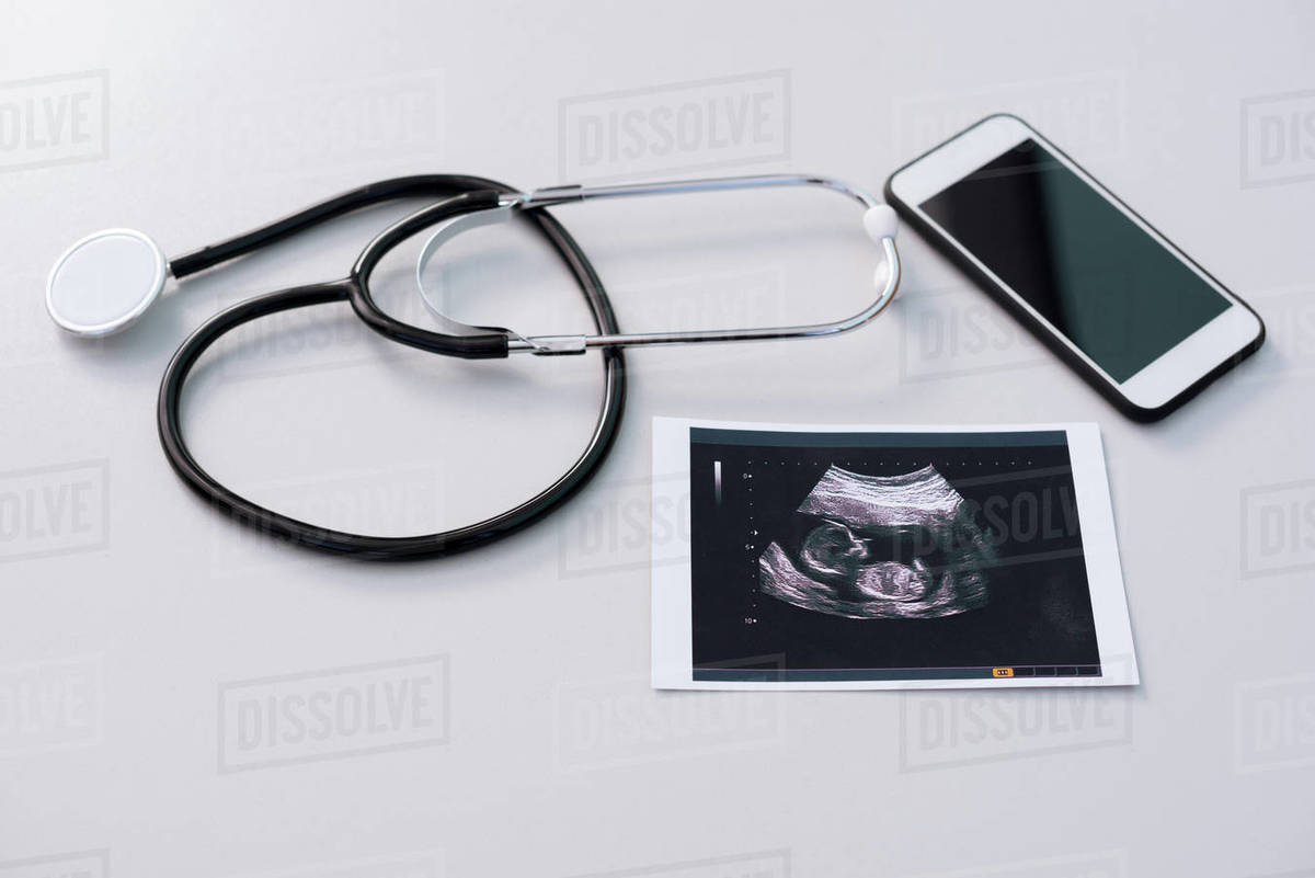 Medical stethoscope with ultrasound investigation result and smartphone ...