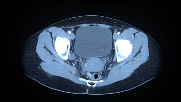 Spine and internal organs MRI scan - Stock Video Footage - Dissolve