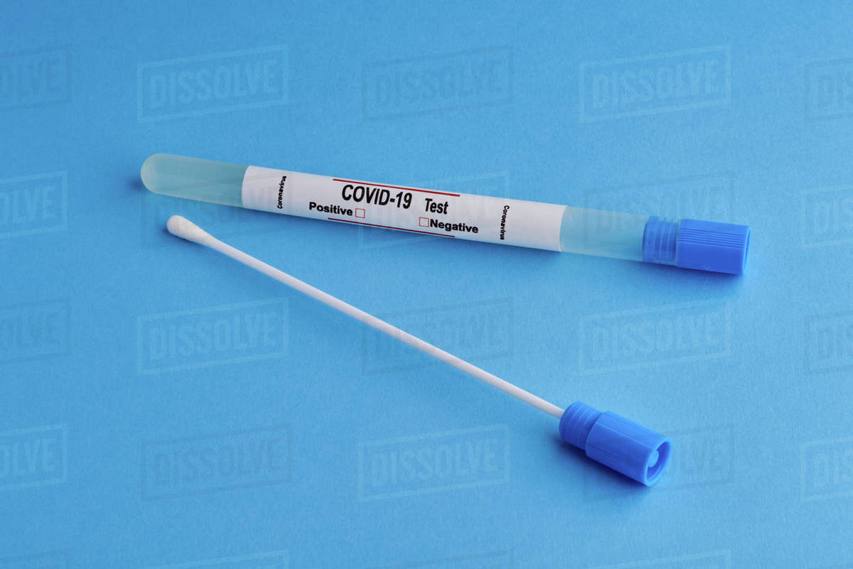 Cotton stick for buccal swab and test tube for COVID 19 diagnostics on ...