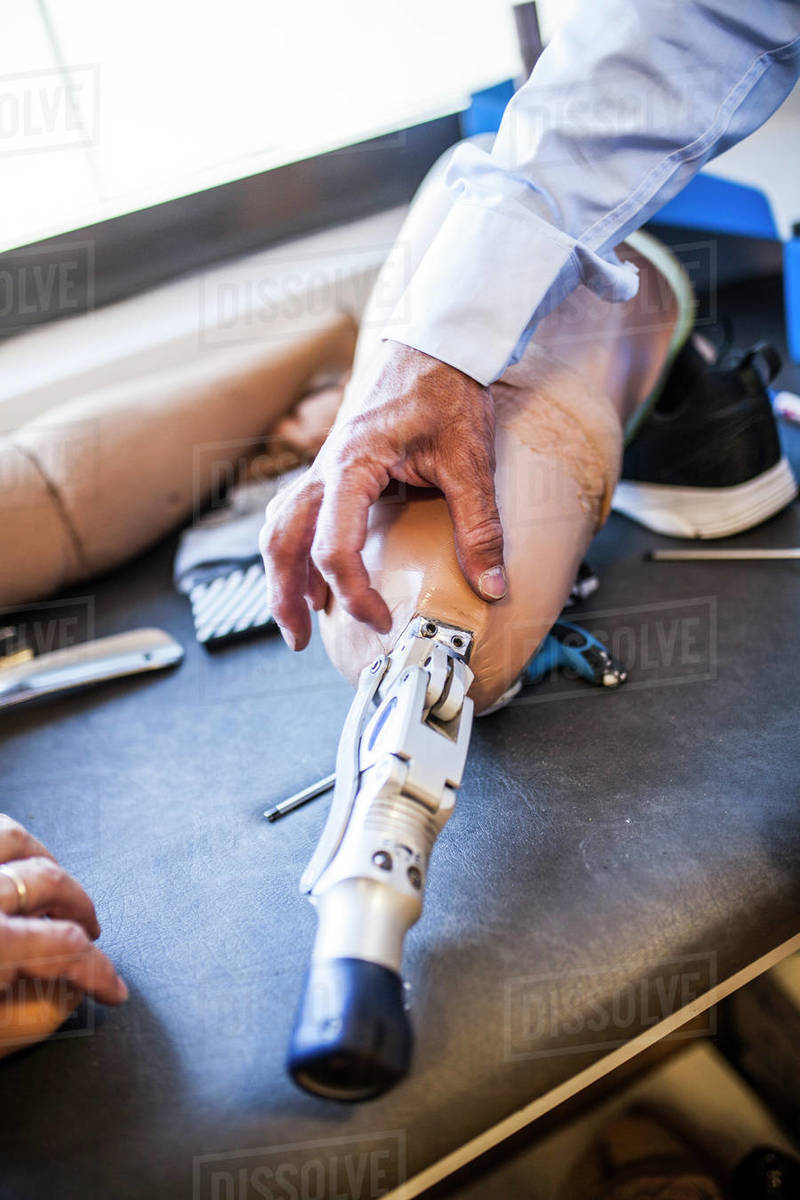 Unrecognizable prosthetic engineer reviewing the prosthesis of a ...
