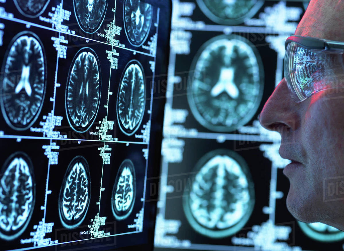 Doctor viewing brain scans for possible disease or damage in clinic ...