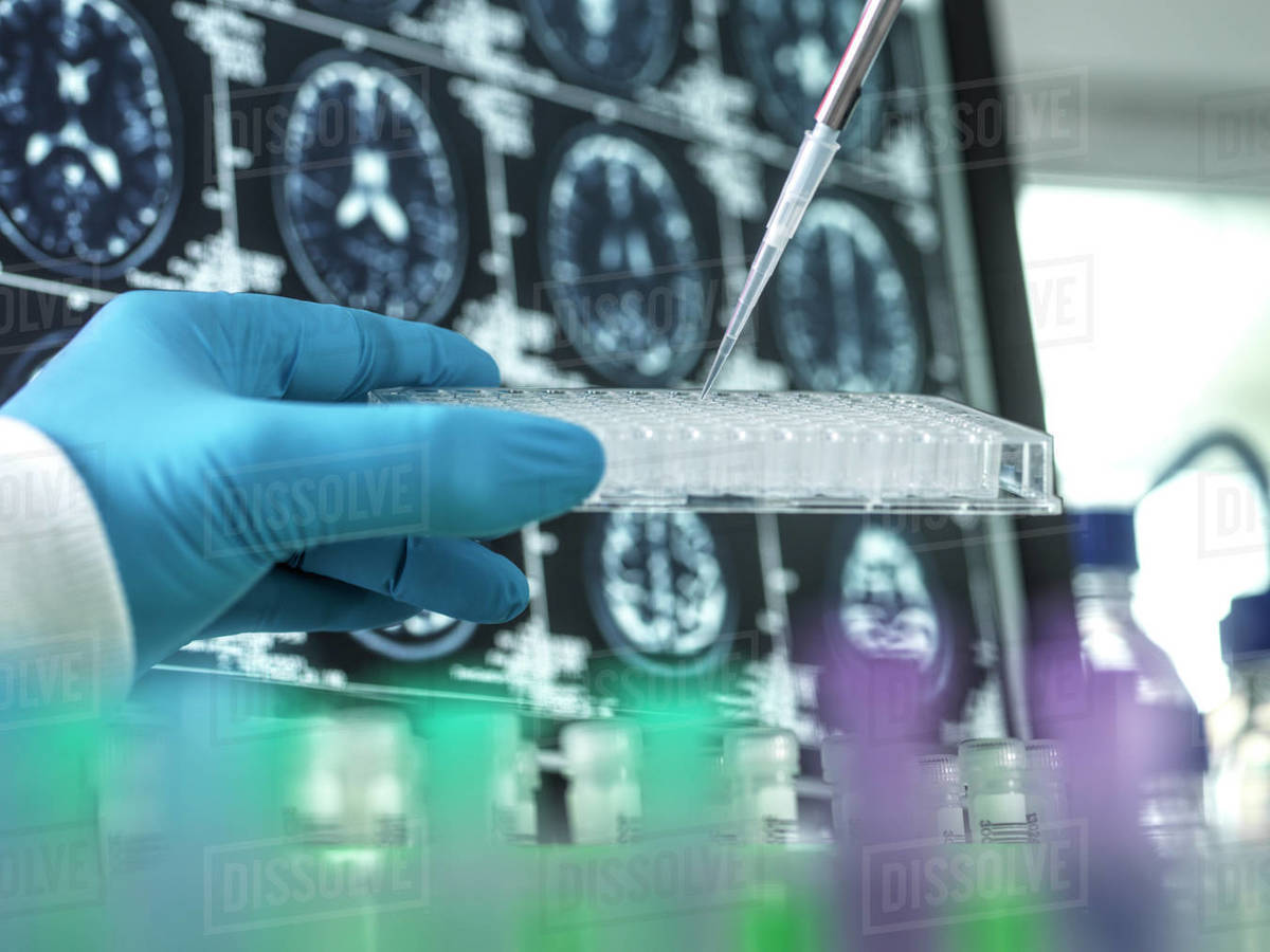 Close-up of gloved hand holding pipette and test tubs in front of brain ...