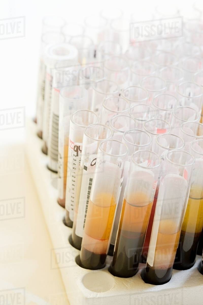 Liquid in test tubes - Royalty-free Stock Photo | Dissolve