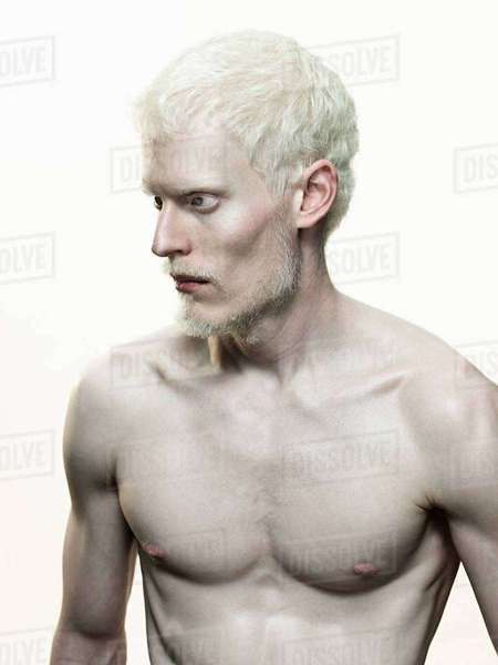 Albino man - Stock Photo - Dissolve