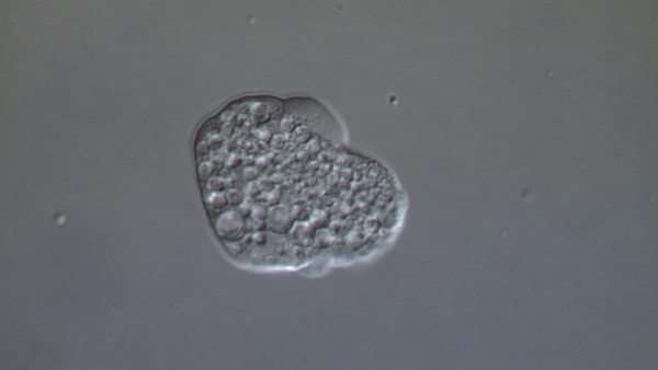 Light microscope footage of a single Entamoeba histolytica protozoan ...
