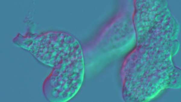 Light microscope footage of Entamoeba histolytica protozoa - HD Rights ...