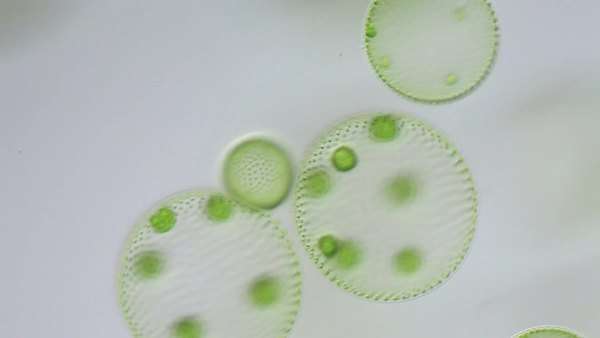 Volvox aureus green alga colonies - HD Rights-managed Stock Video ...