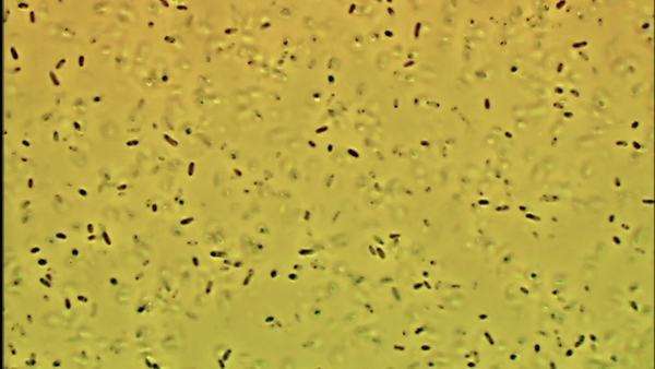 Bacteria, light microscopy footage - HD Rights-managed Stock Video ...