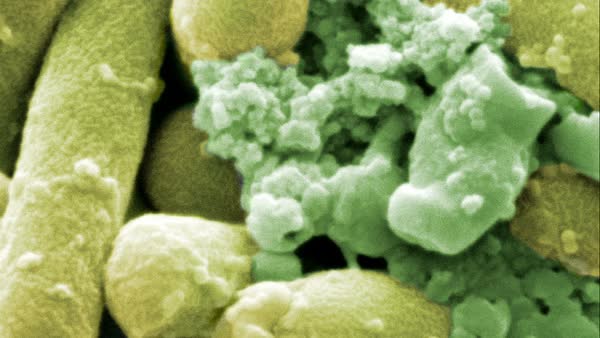 Animated scanning electron micrograph (SEM) of Clostridium difficile ...