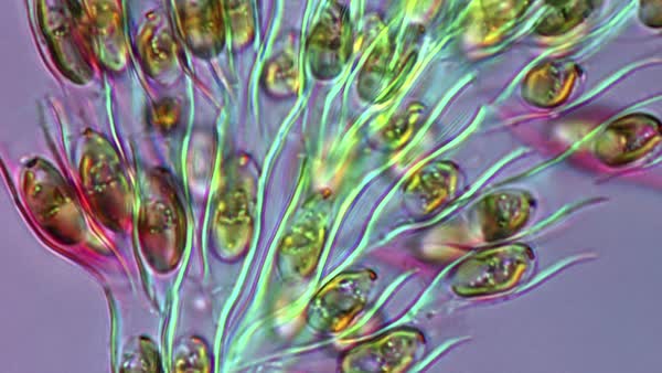 Golden algae. Animated polarised light micrograph of a colony of ...