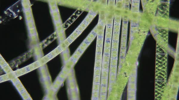 Ciliates on algae. Light microscope footage of ciliate protozoa moving ...