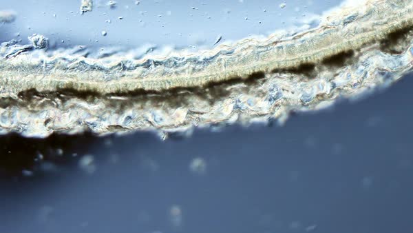 Mustard seed coat absorbing water. Light microscope showing the seed ...