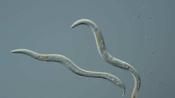Light microscope footage of two Nematodes of undetermined genus taken ...