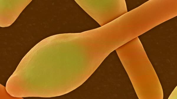 Animated coloured scanning electron micrograph (SEM) of Clostridium ...