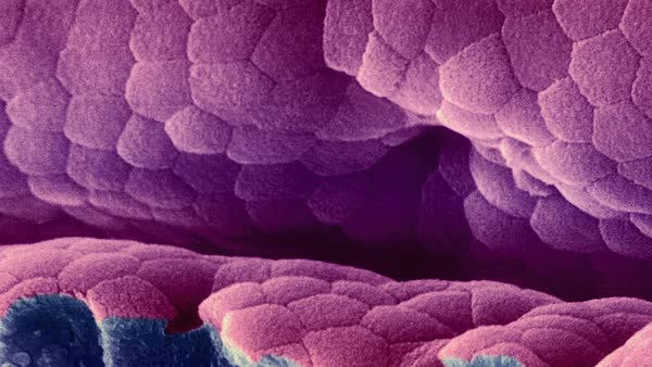 Villus surface of the small intestine; columnar epithelial cells ...