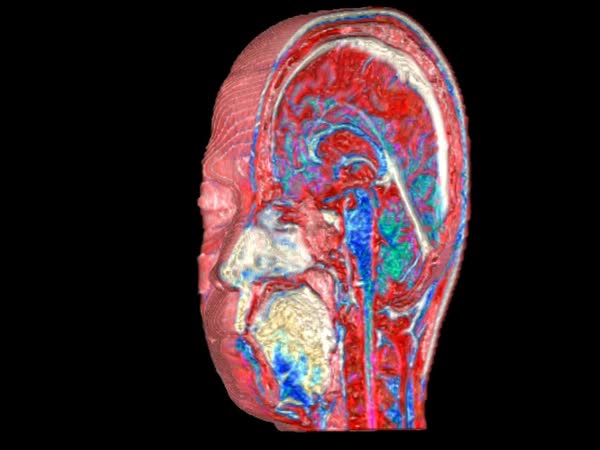 Brain and spinal cord, rotating sagittal MRI scan - Stock Video Footage ...