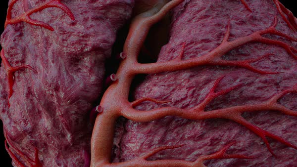 Right coronary artery, atrioventricular groove - HD Rights-managed ...