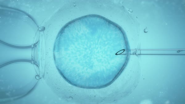 Ivf, In Vitro Fertilisation Through A Microscope - Stock Video Footage ...