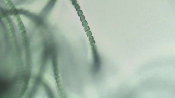 Microscopic view of Phormidium sp. blue green algae as they slowly into ...