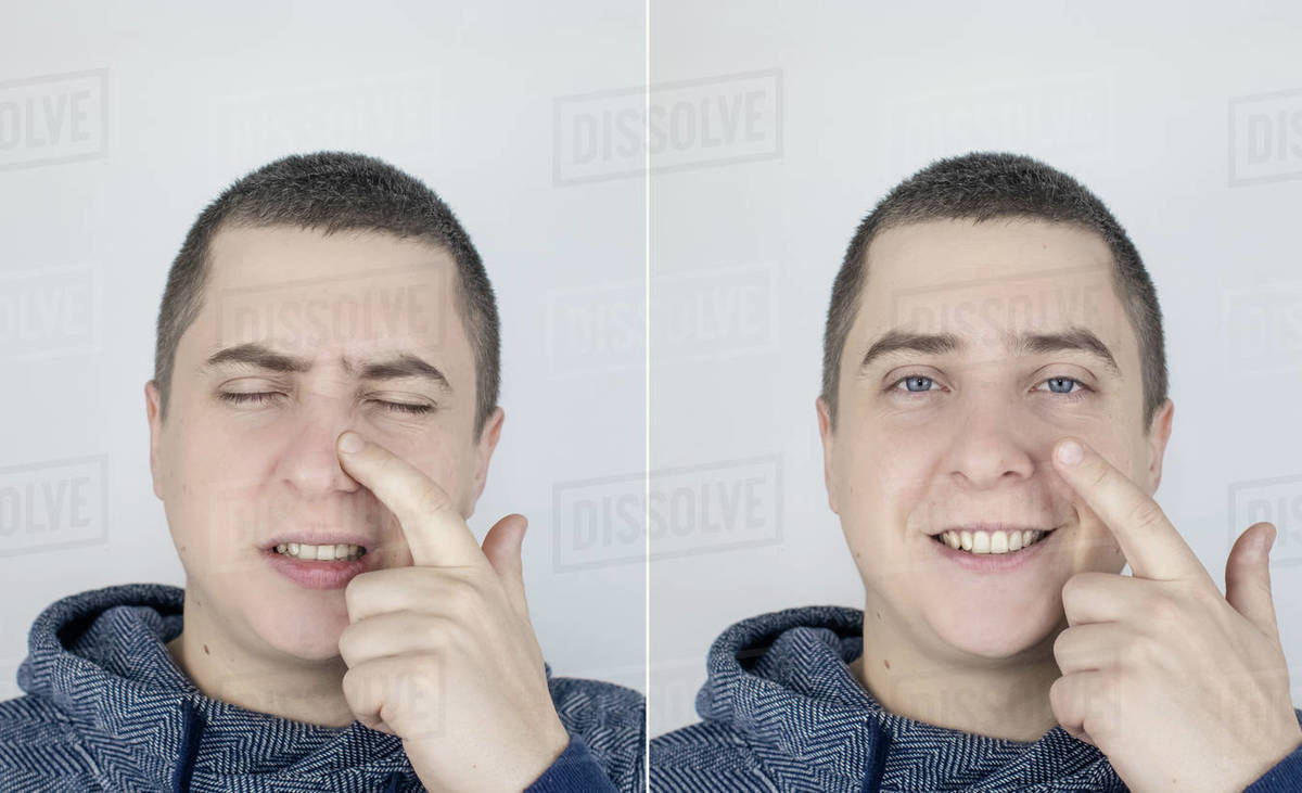 Before and after. On the left, the man indicates nose pain, and on the ...