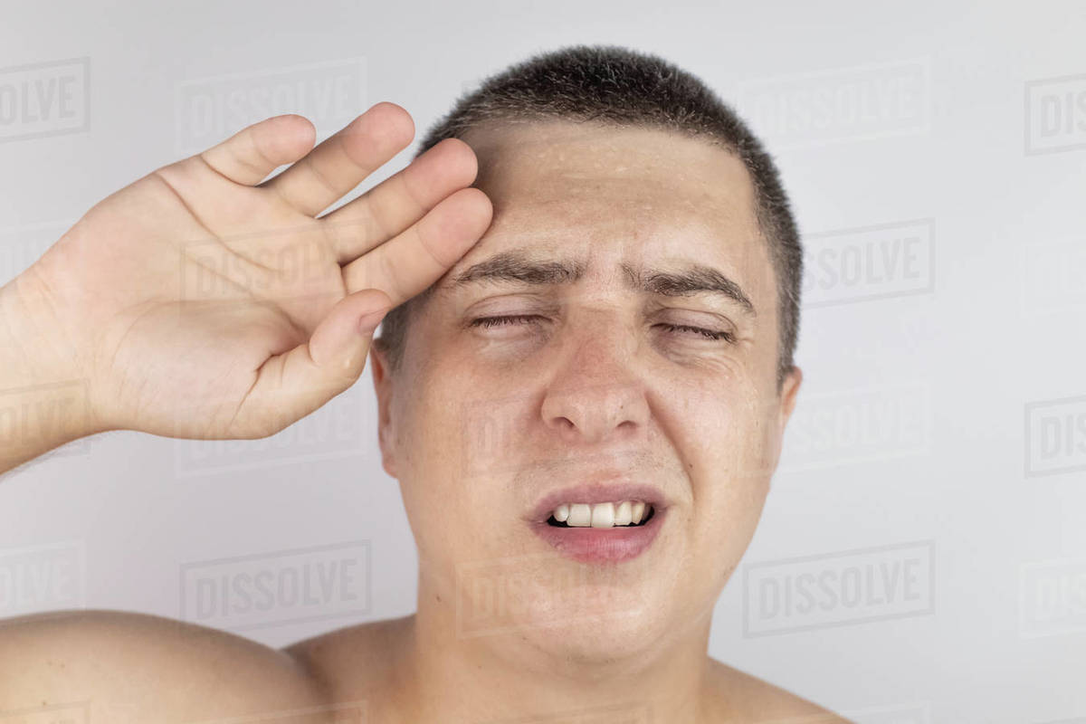 A man with sweating on his face is looking at the camera. Sweat gland ...