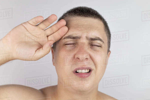 A man with sweating on his face is looking at the camera. Sweat gland ...