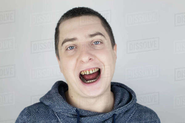 The man has rotten teeth, teeth fell out, yellow and black teeth hurt ...