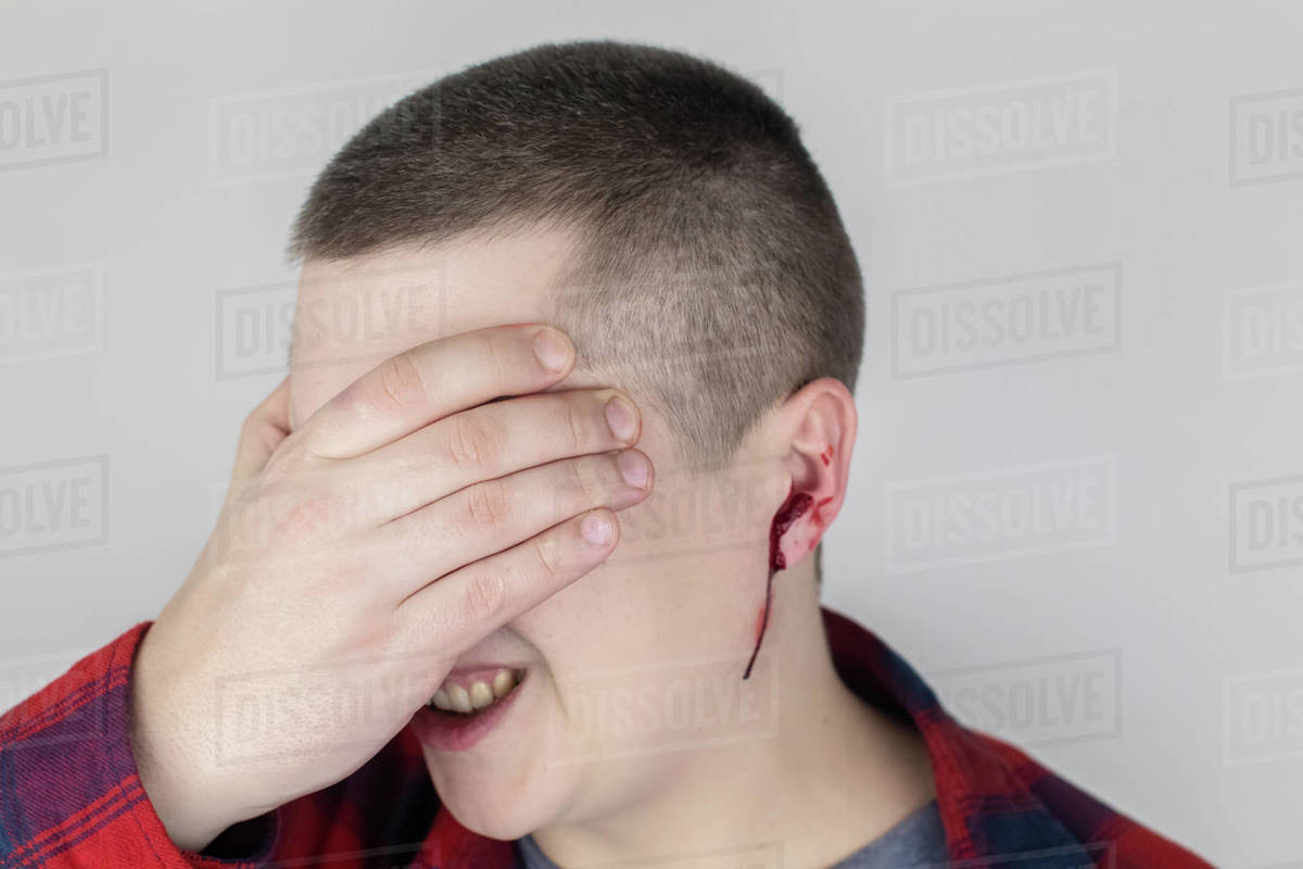 A man whose ear is bleeding. Vascular rupture, damage to the tympanic ...