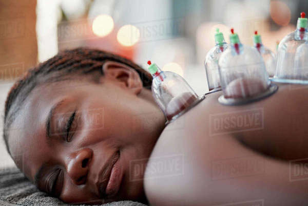 Black woman, face and smile in cupping therapy on back for pain relief ...