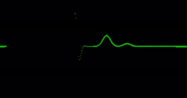 Green digital pixelated EKG monitor shows healthy heart beat - 4K ...