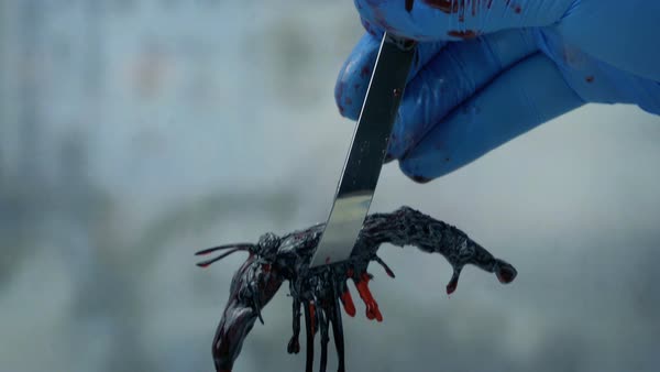 Alien Implant Removed From Body - HD Royalty-free Stock Video Footage ...