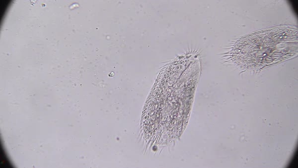 Microscopic view of Stylonychia Ciliophora. - Stock Video Footage ...
