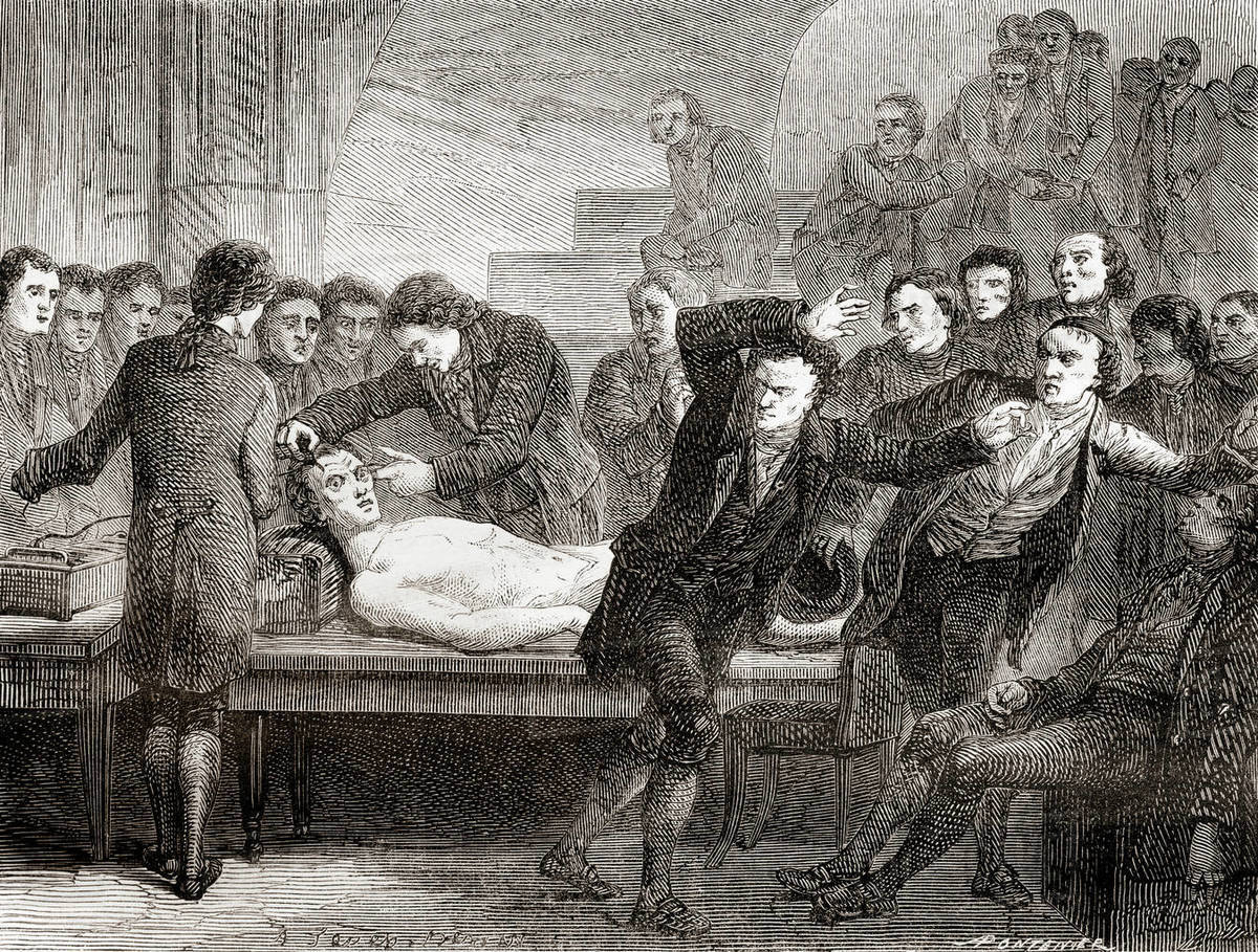 The galvanisation of the executed murderer Matthew Clydesdale by Dr ...