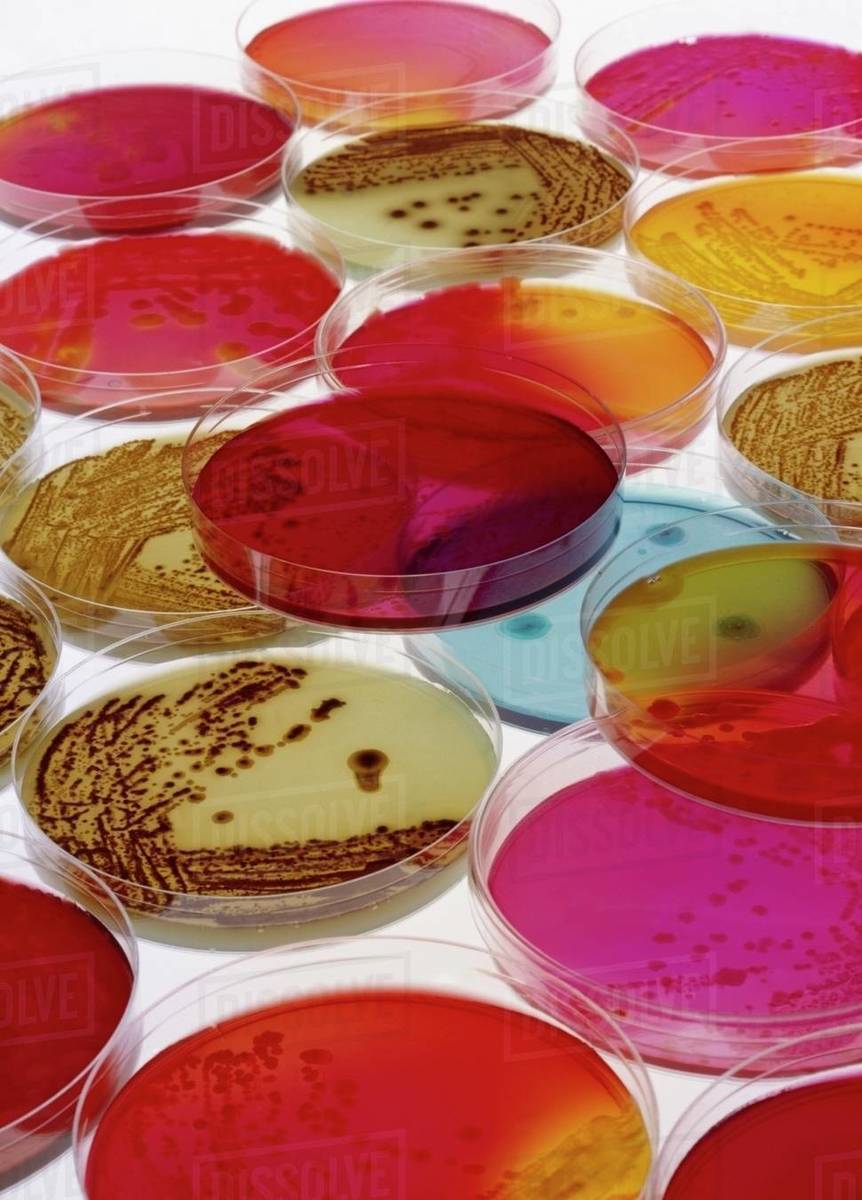 Petri Dishes With Bacteria - Royalty-free Stock Photo | Dissolve