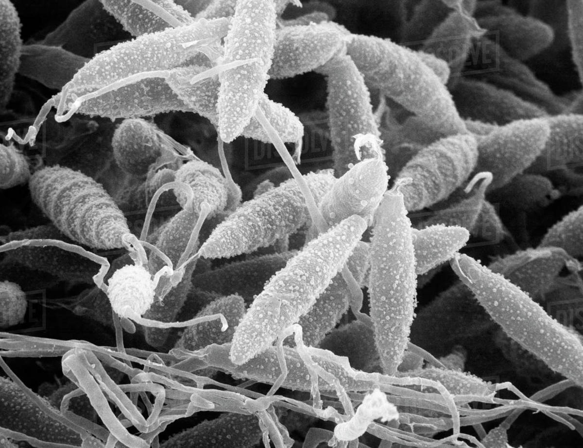 Scanning electron microscopic view of a fungus (Microsporum gypseum ...