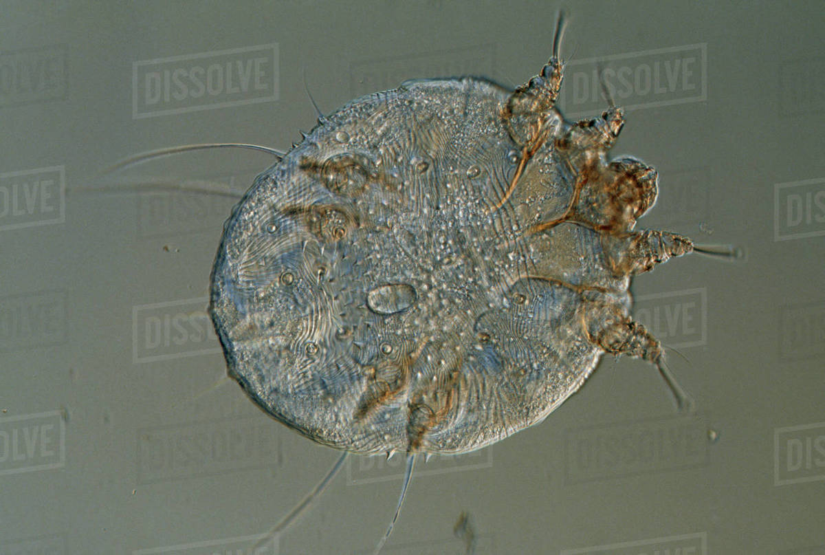 Microscopic view of a scabies mite (Sarcoptes scabiei), which causes a ...