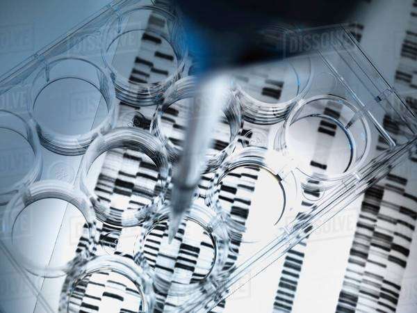 Pipette adding DNA sample to tray for DNA testing, DNA gel results in ...