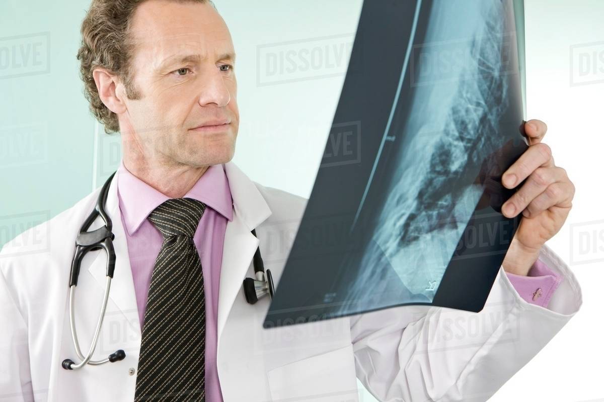 A doctor holding an x-ray - Stock Photo - Dissolve